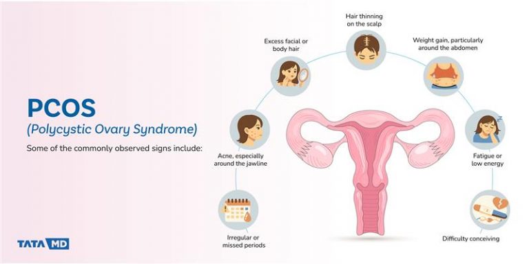 PCOS Treatment in Whitefield, Bangalore: Symptoms, Causes & What ...